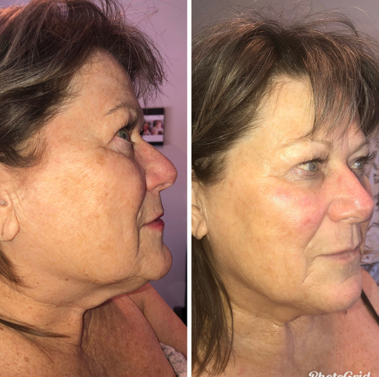 FaceFit Canada | Experience a natural facelift – FACEFIT CANADA