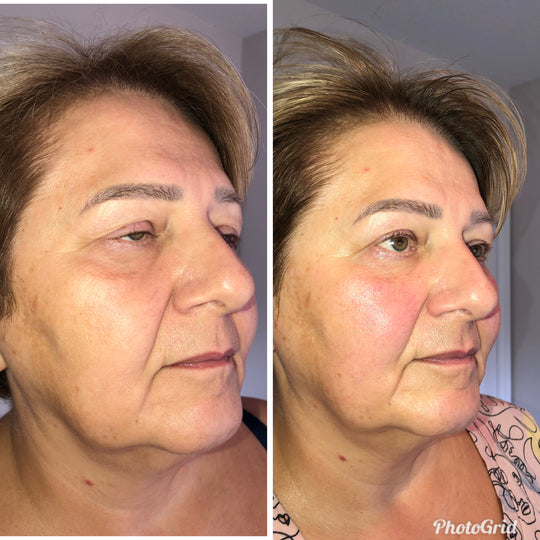 FaceFit Canada | Experience a natural facelift – FACEFIT CANADA